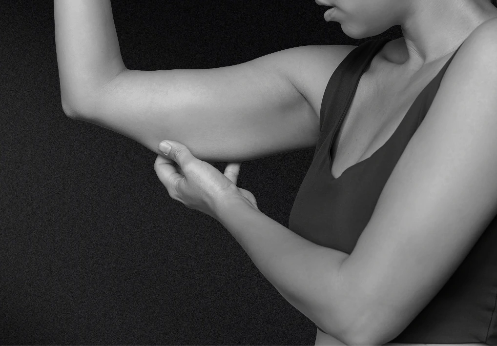 Awake Arm Lift in Long Island, NY | AgeFocus